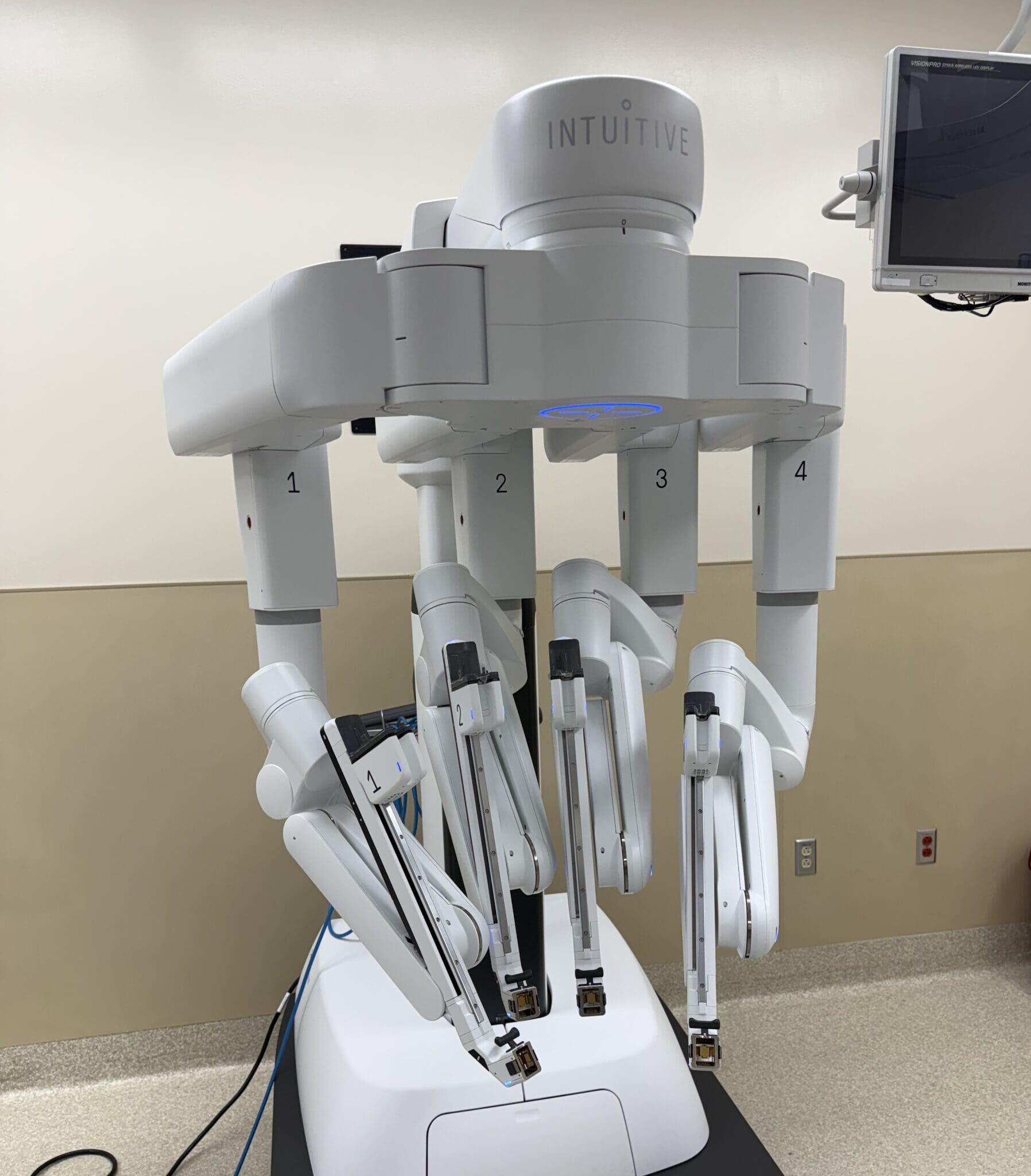 Golden Valley Memorial Healthcare Introduces New Robotic Surgery System ...